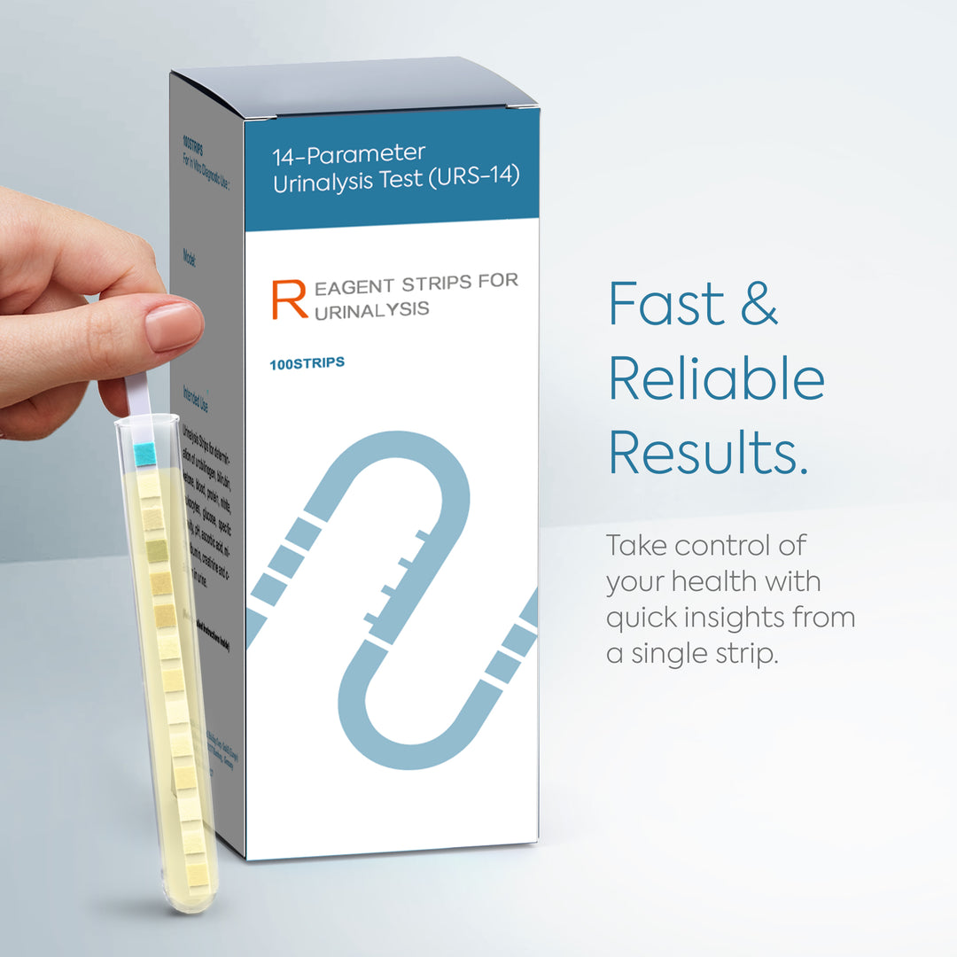 URS 14-in-1 Urinalysis Test Strips - 100 Count – Diagnox Health