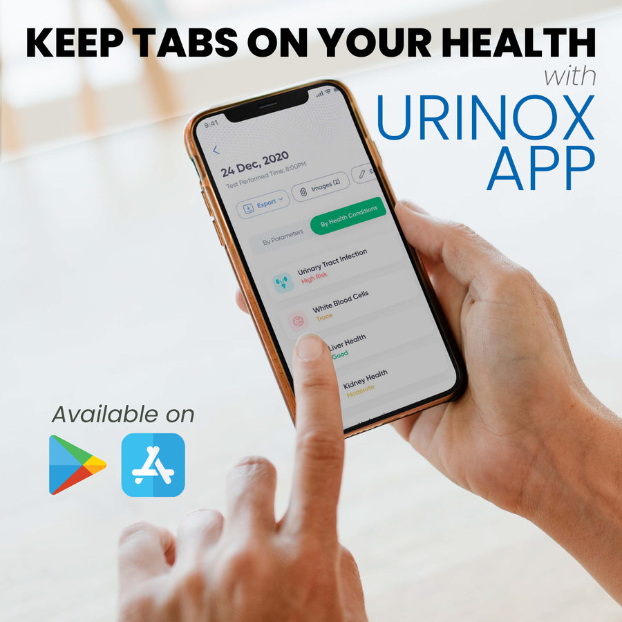 Urinox-10 Urinalysis Test Strips - 20 Tests/Bx – Diagnox Health